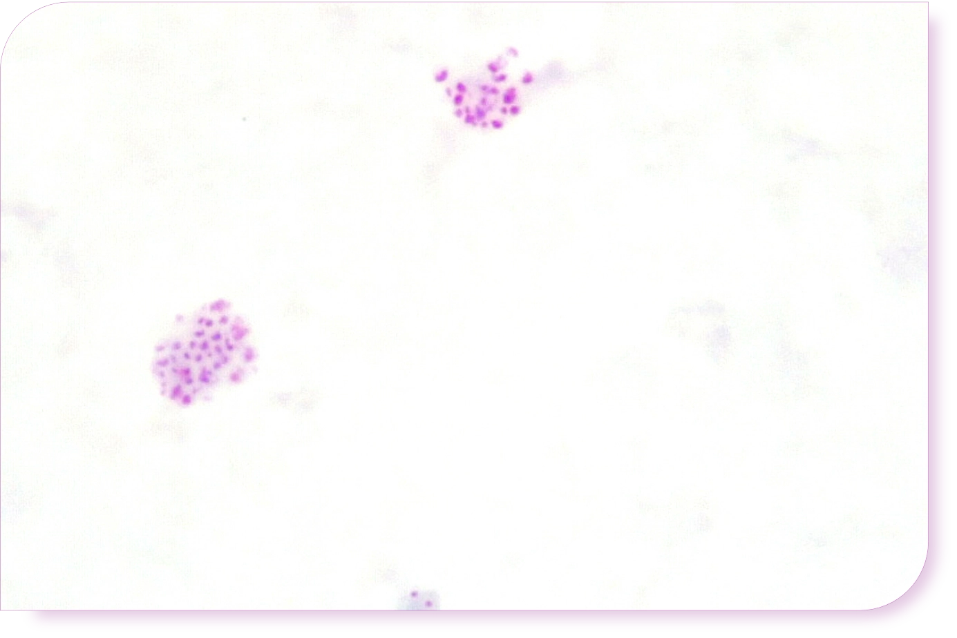 Research Initiatives | Protibea Therapeutics